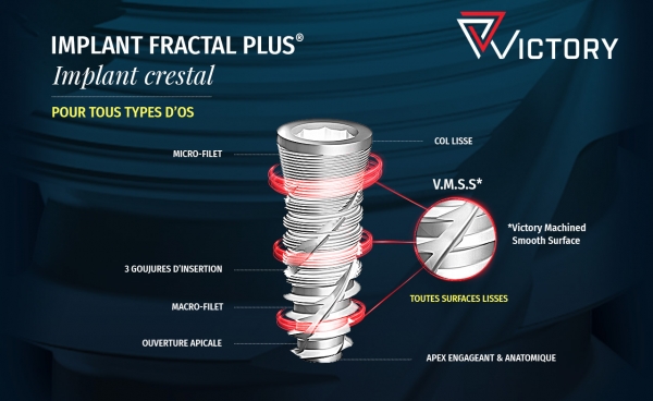 Implant Fractal Plus®